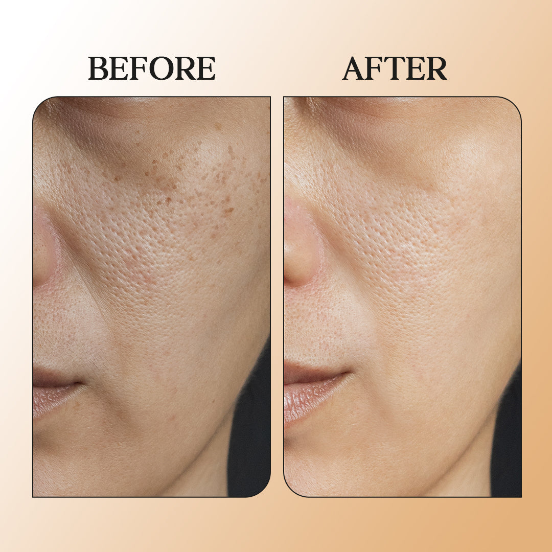 Best Skin Care Products | Best Face Moisturizer & Oil | Divyaa – Divyaa ...